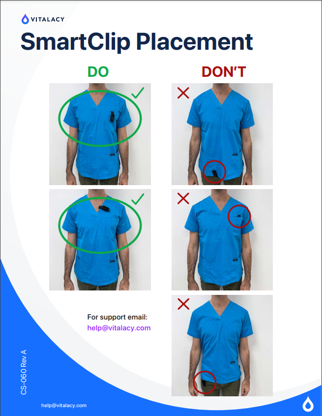 SmartClip Placement Guide – Vitalacy
